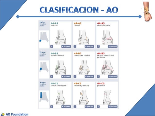 FRACTURAS DE TOBILLO