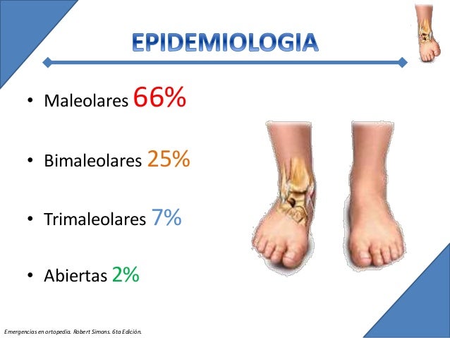 FRACTURAS DE TOBILLO