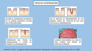 Seminario heridas y fases de cicatrización | PPT