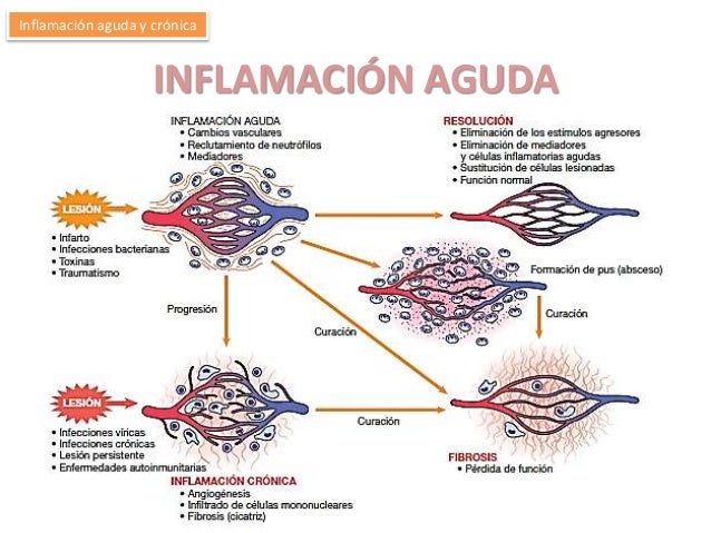 Inflamación Aguda y Crónica