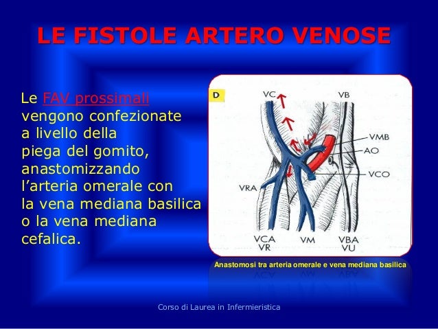 Seminario la dialisi 4 11-2013
