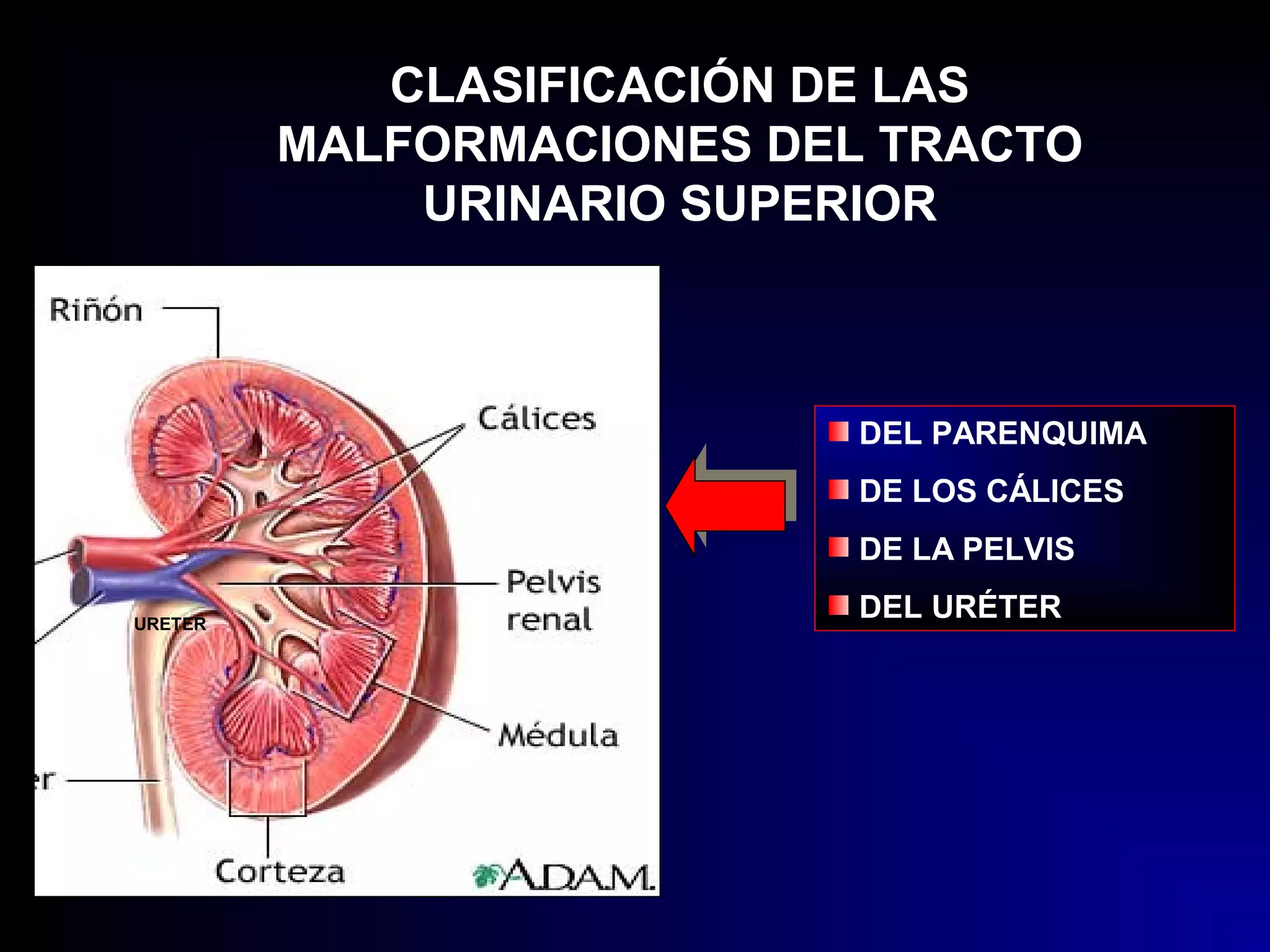 La Malformaciones renales en Imagenología | PPT