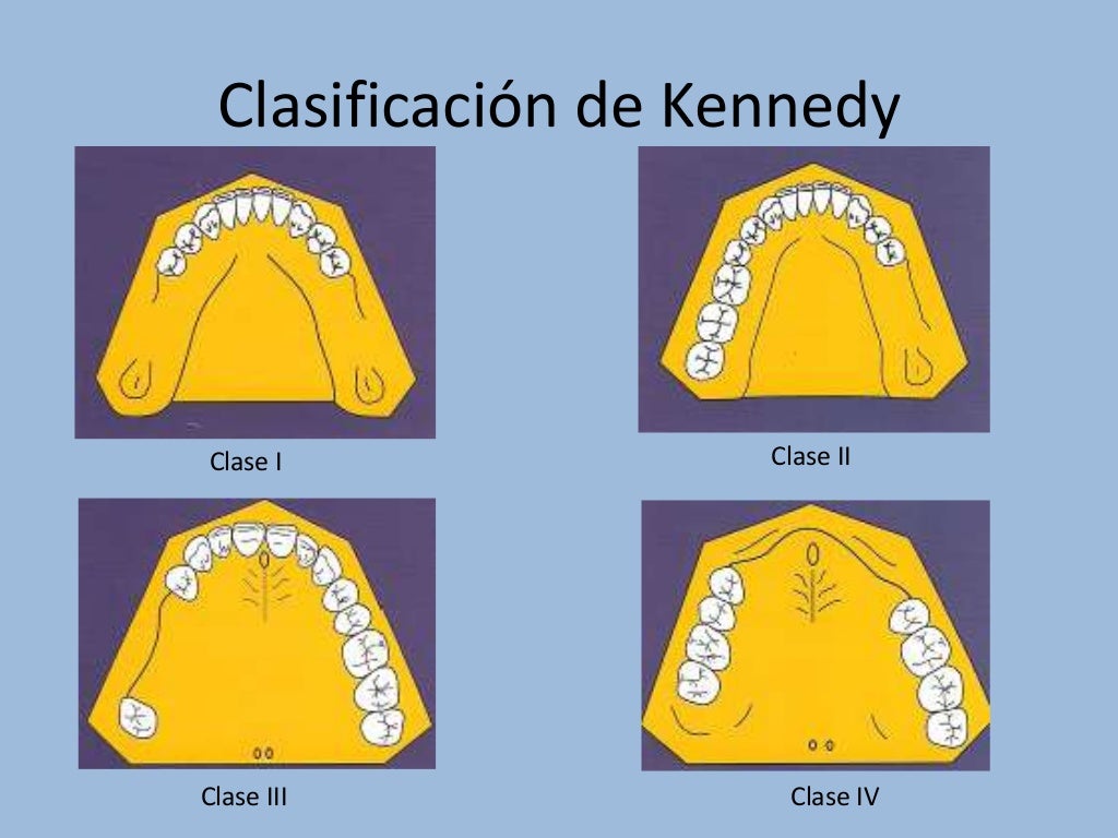 Seminario n°12 kennedy
