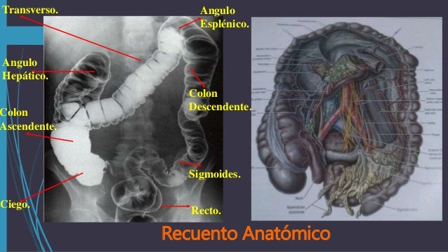 Las patologías del colon en Imagenología