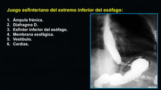 Patologías de esófago en Imagenología | PPTX