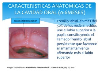 Patología oral del recién nacido, labio y paladar hendido | PPTX