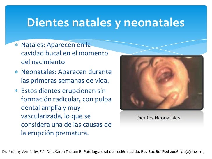 Patología oral del recién nacido, labio y paladar hendido