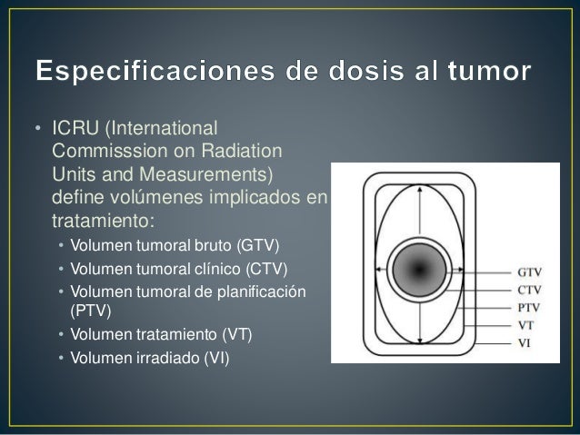 Curvas de Isodosis (radioterapia)