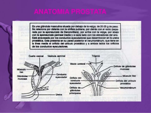 SINDROME PROSTATICO
