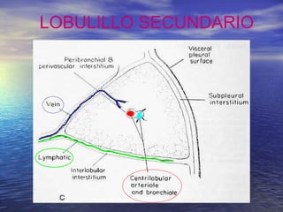 Radiología Pulmonar: Lesiones Consolidativas del Parénquima. | PPT
