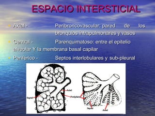Radiología Pulmonar: Lesiones Consolidativas del Parénquima. | PPT
