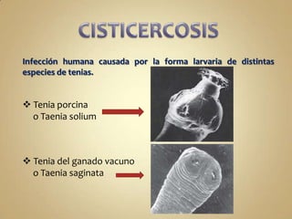 Cisticercosis | PPTX