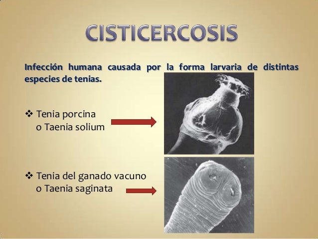 Cisticercosis