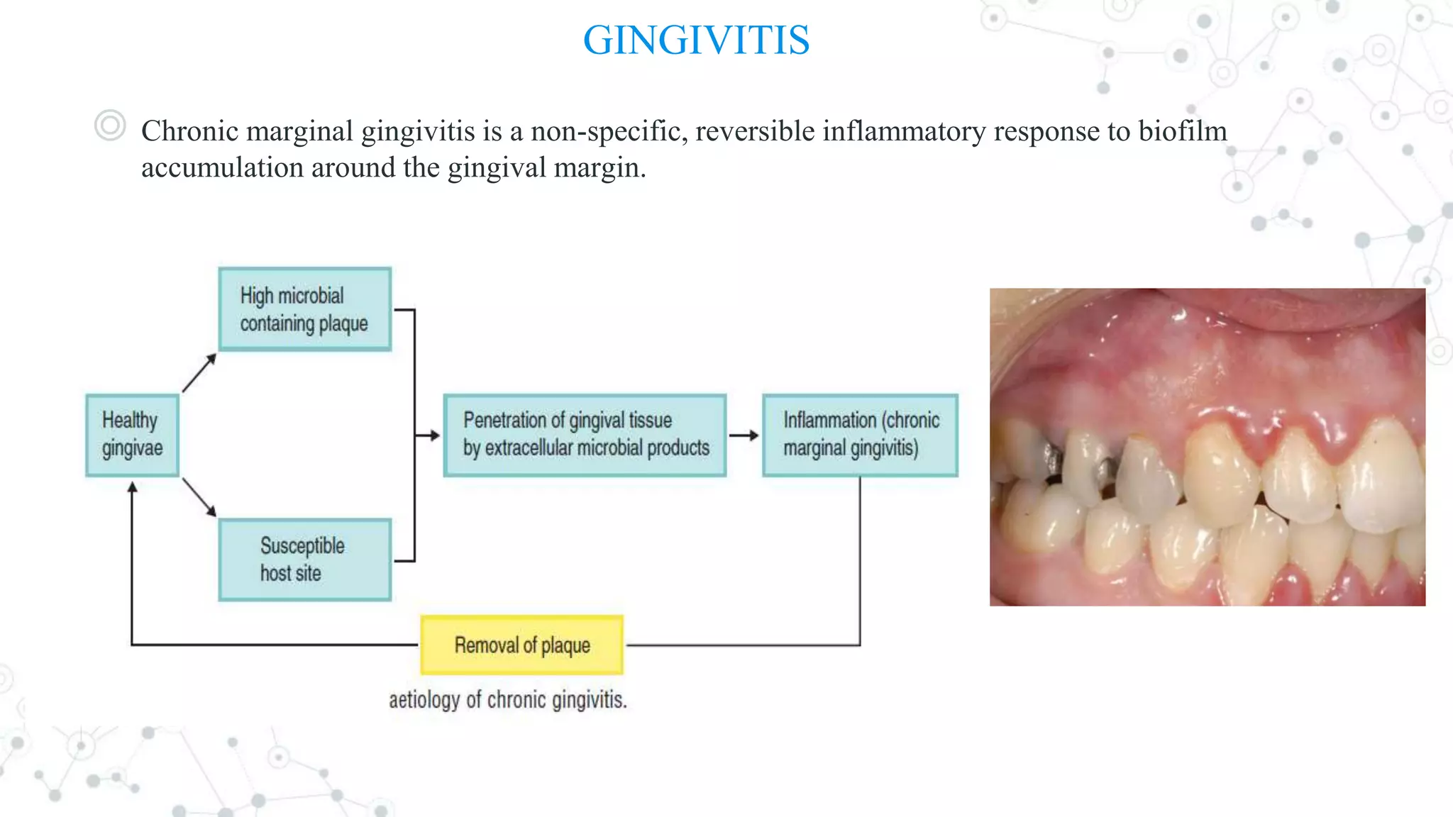 SEMINAR IV ORAL MICROFLORA.pptx