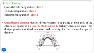 Management of Kennedys Class III Classification | PPTX