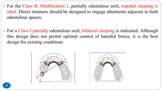 Management of Kennedys Class III Classification | PPTX