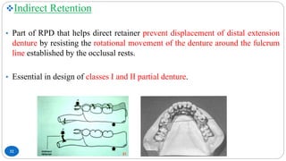 Management of Kennedys Class III Classification | PPTX