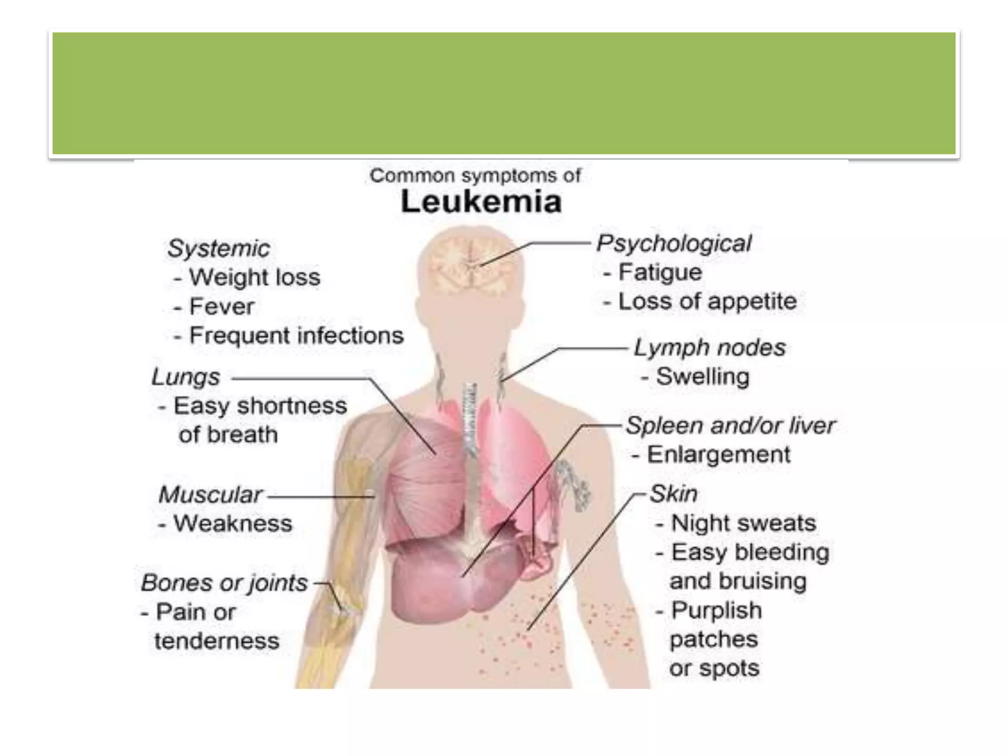 Leukemia.pptx