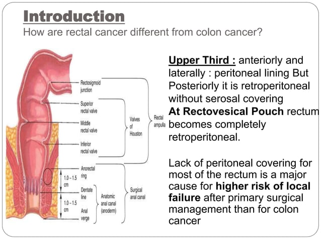 Management of Rectal Cancer | PPTX