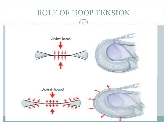 meniscal injuries