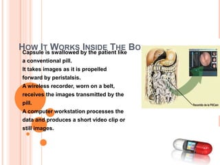 Seminar on microelectronic pill | PPTX