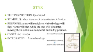 Primitive Reflexes.pptx