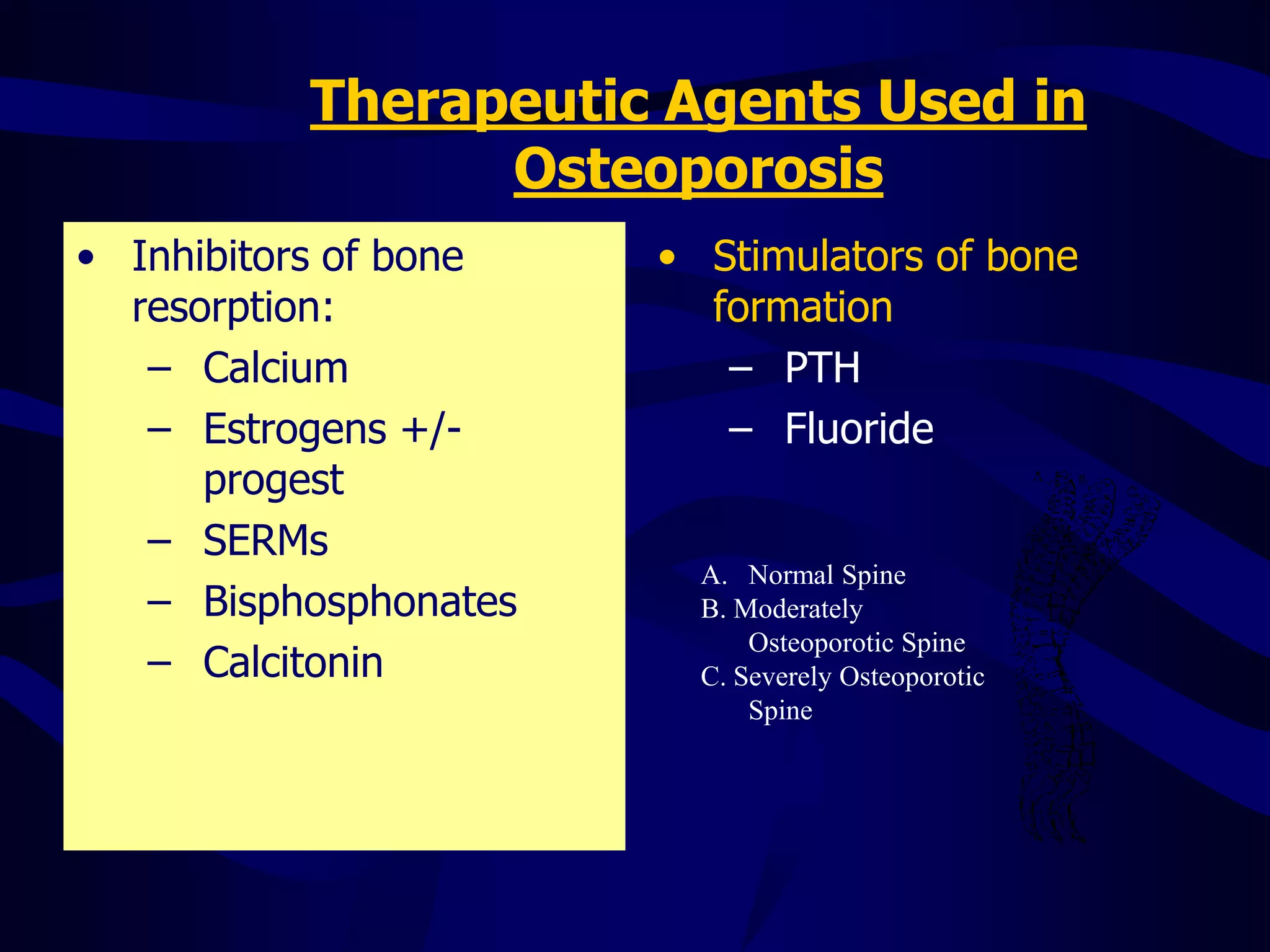 osteoporosis | PPTX