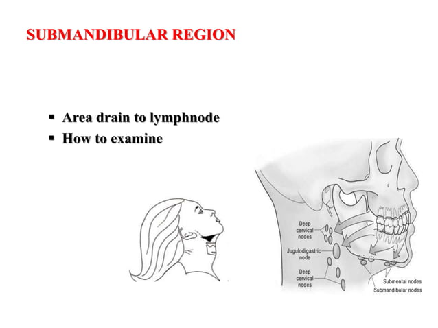 Differential Diagnosis of Lymphadenopathy | PPTX | Ear, Nose and Throat ...