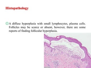 Differential Diagnosis of Lymphadenopathy | PPTX