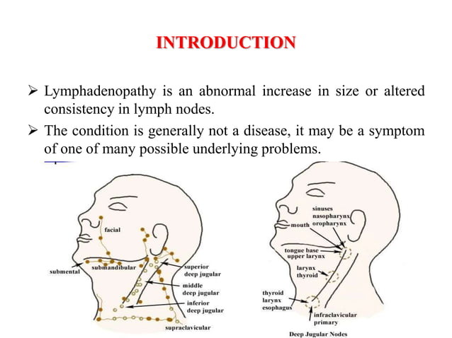 Differential Diagnosis of Lymphadenopathy