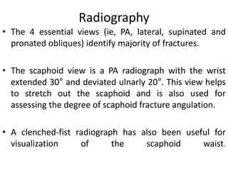 scaphoid and lunate fractures | PPTX