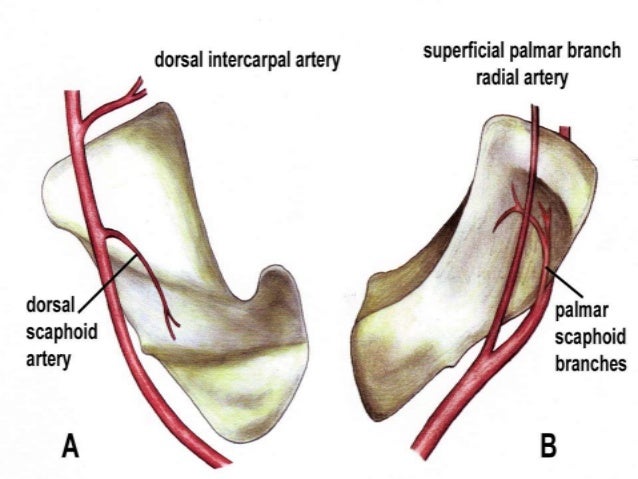 Scaphoid Lunate Fracture CASE REPORTS