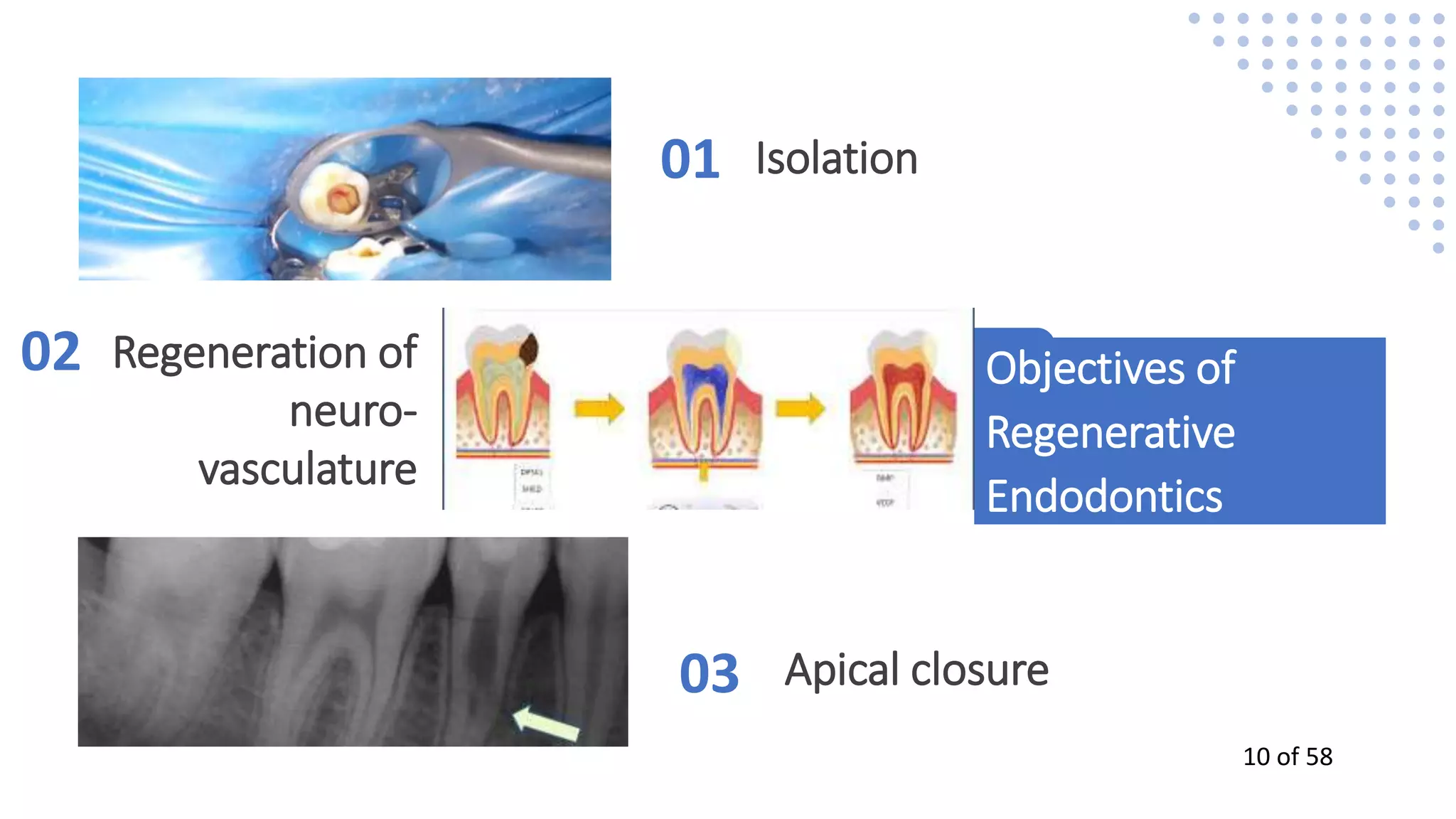 Regenerative Endodontics | PPTX