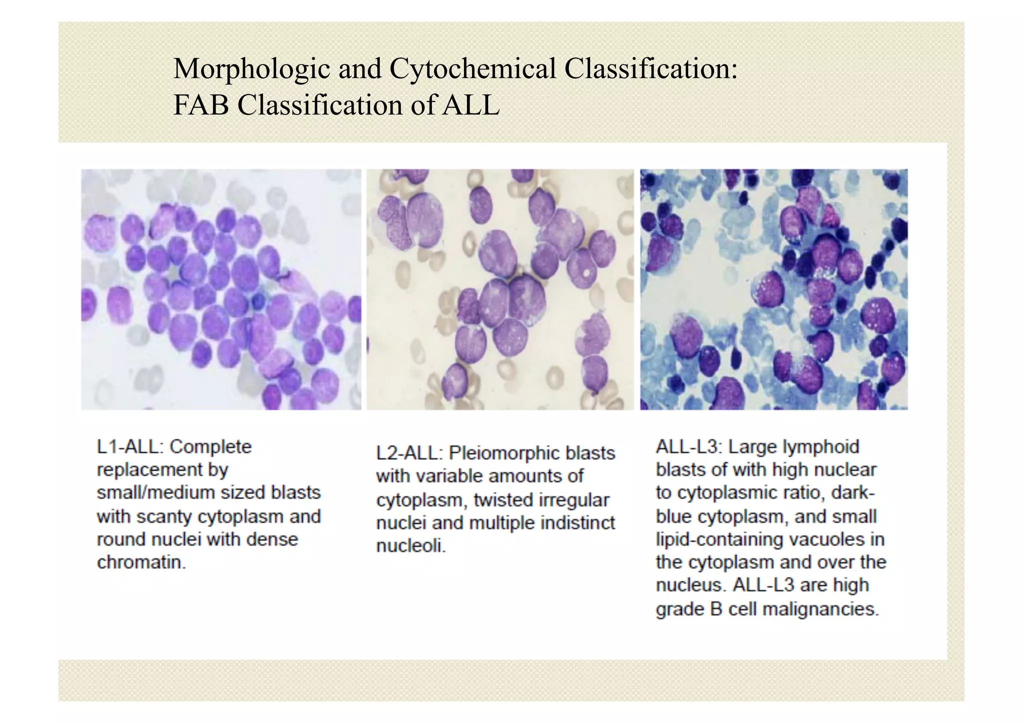Seminar on acute lymphoblastic leukemia by Dr. Prachi Kalra | PDF ...
