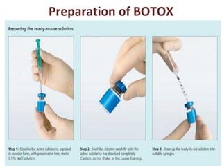BOTOX injection and Rehabilitation after BOTOX | PPT