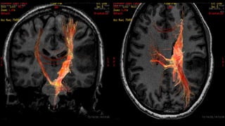 Seminar on Brain Mapping techniques.pptx