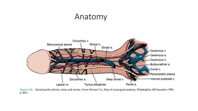 Seminar on carcinoma penis | PPTX