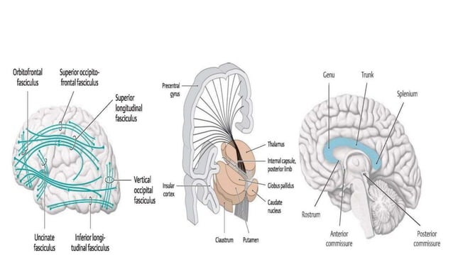 Seminar Cerebral neurolocalization | PPTX