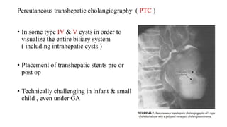Seminar on choledochal cyst | PPTX