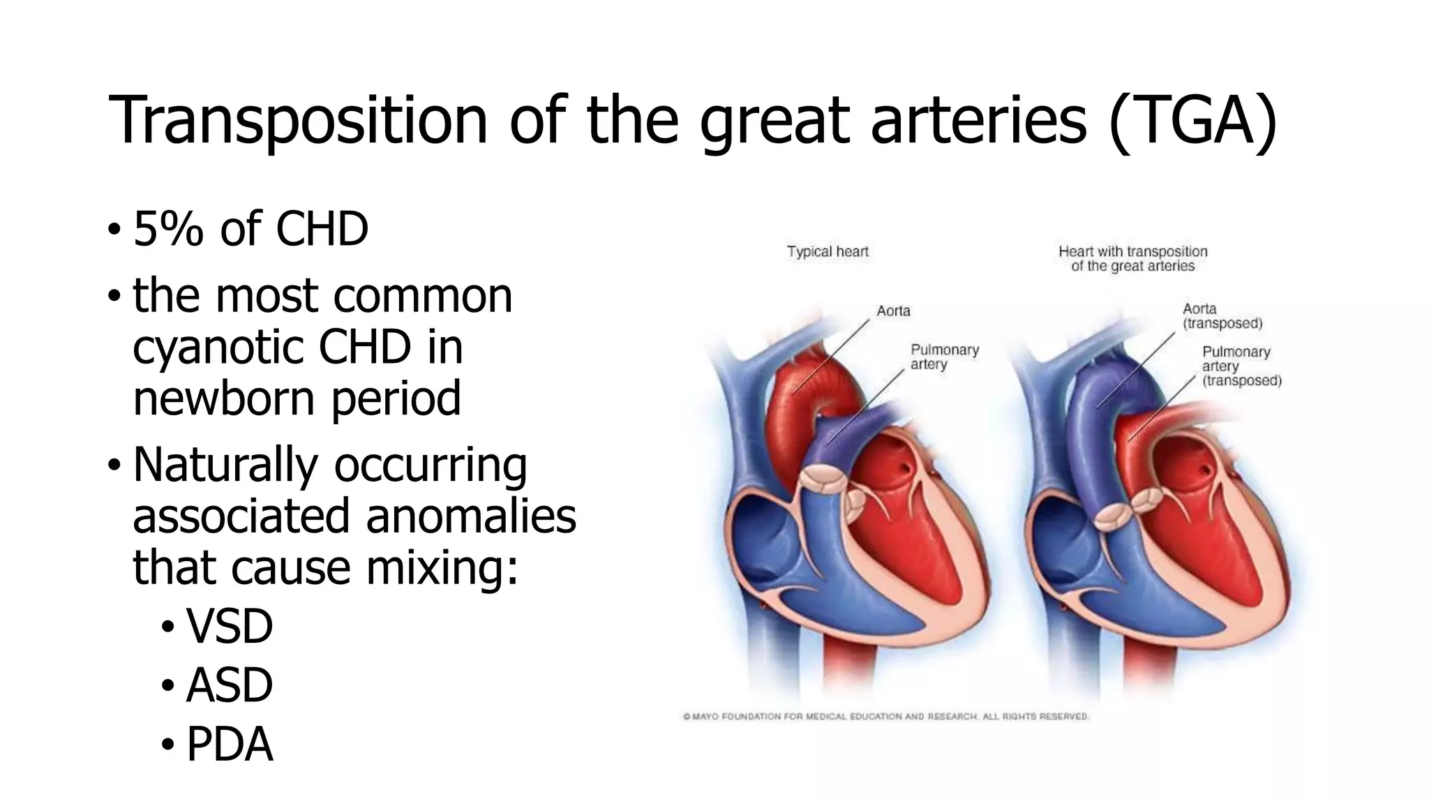 Seminar on critical Congenital heart disease Dr Habibur Rahim | Dr ...