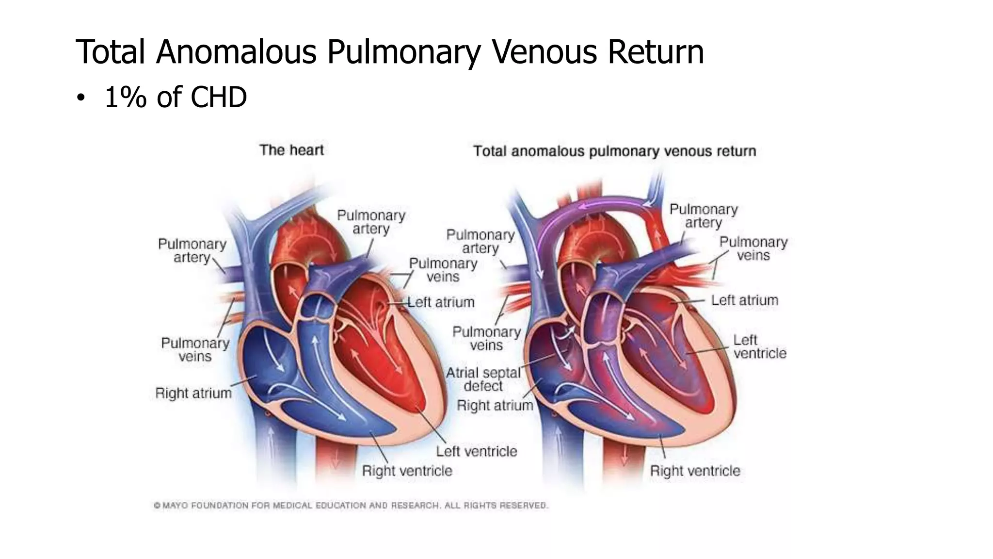Seminar on critical Congenital heart disease Dr Habibur Rahim | Dr ...