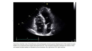 Seminar on critical Congenital heart disease Dr Habibur Rahim | Dr ...
