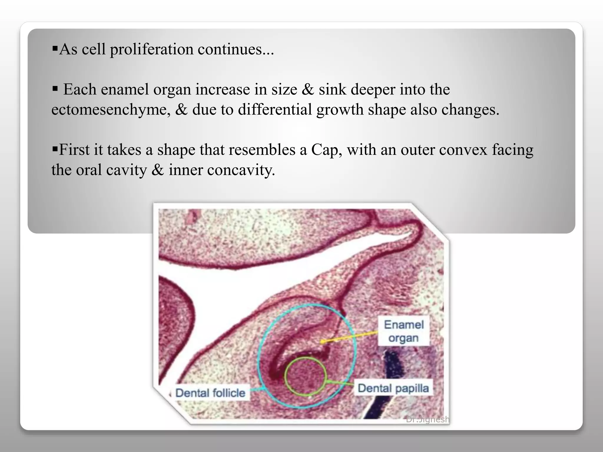 Development of periodontium | PPTX