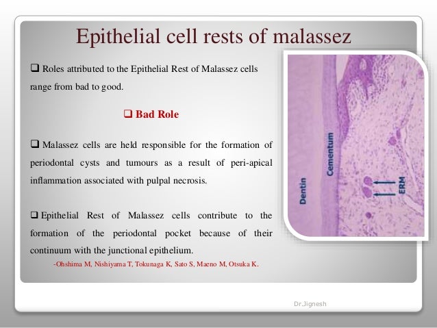Development of periodontium