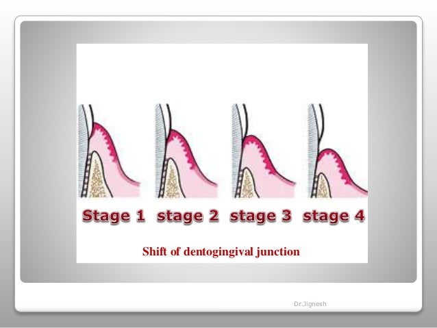 Development of periodontium