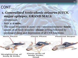 EPILEPSY | PPTX