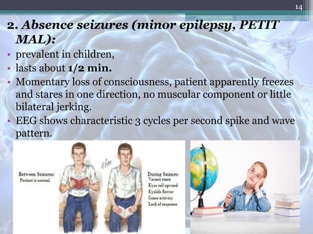 EPILEPSY | PPT