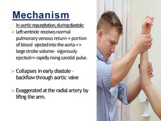 Carotid Pulse Palpation