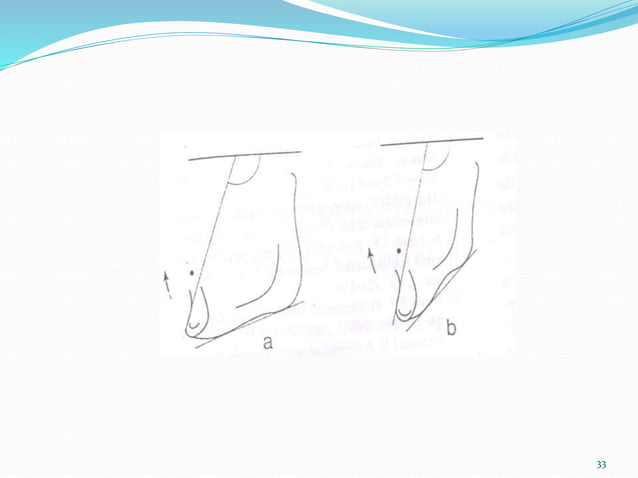 GROWTH ROTATION | PPTX