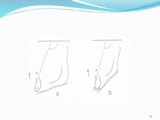 GROWTH ROTATION | PPTX